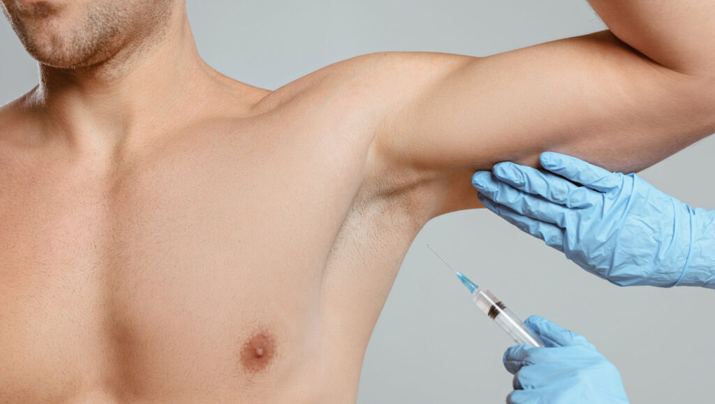 Botox for Sweat Reduction: How Hyperhidrosis Treatment Works and Lasts